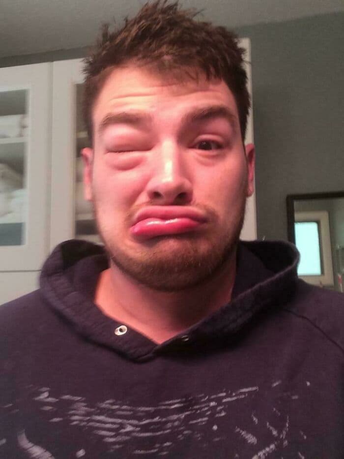 30 Extremely Unfortunate Situations People Had To Deal With