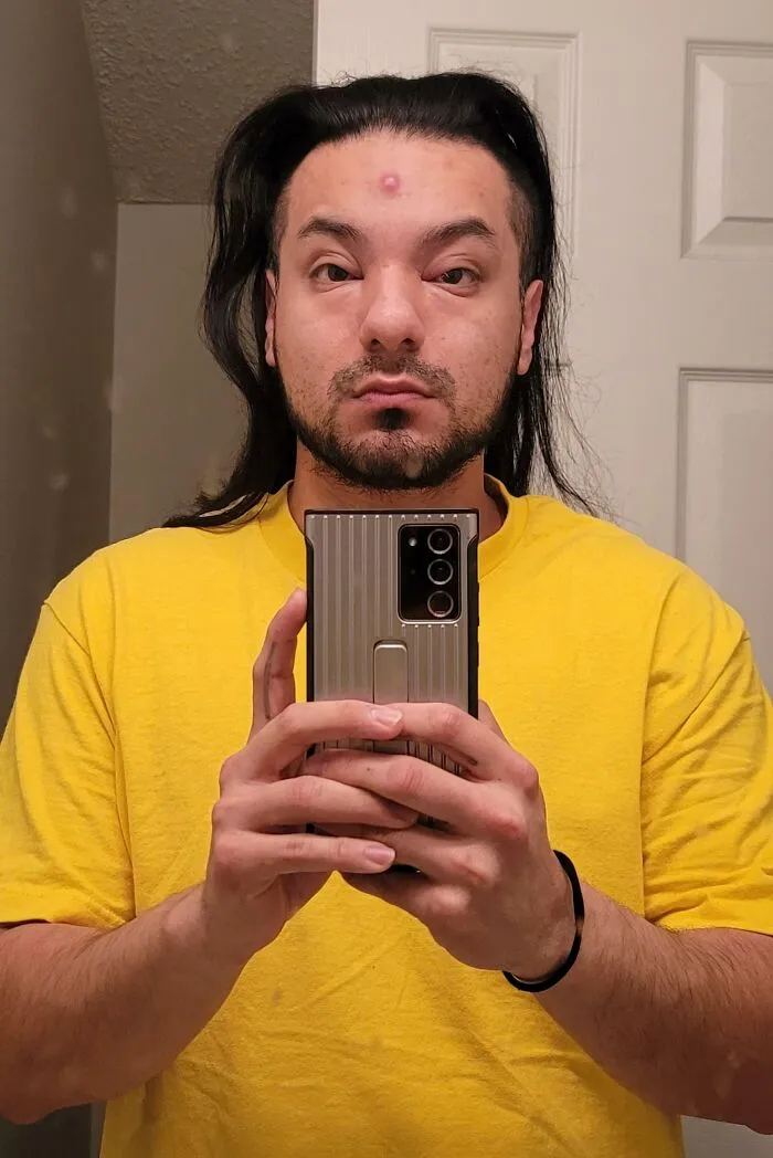 30 Extremely Unfortunate Situations People Had To Deal With